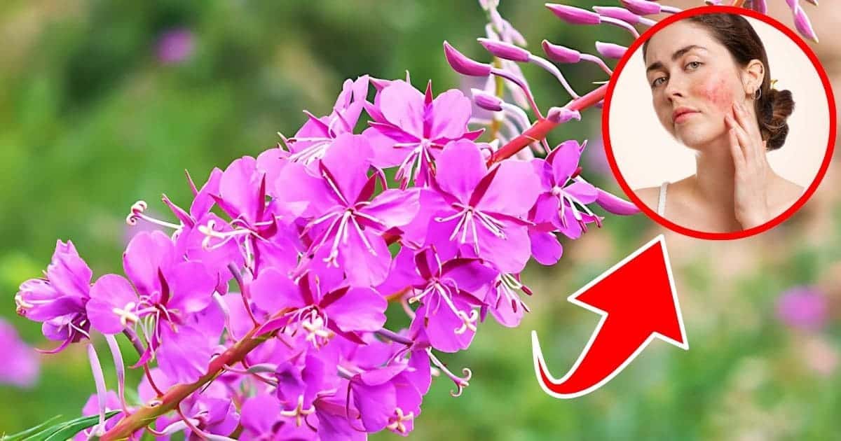8 Amazing Health Benefits of Fireweed Your Body Needs